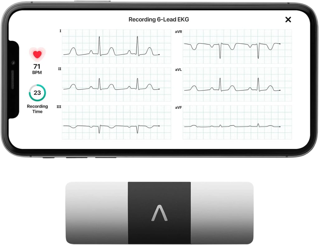 KardiaMobile 6-Lead Personal EKG Monitor: $119 - KM-6L-E