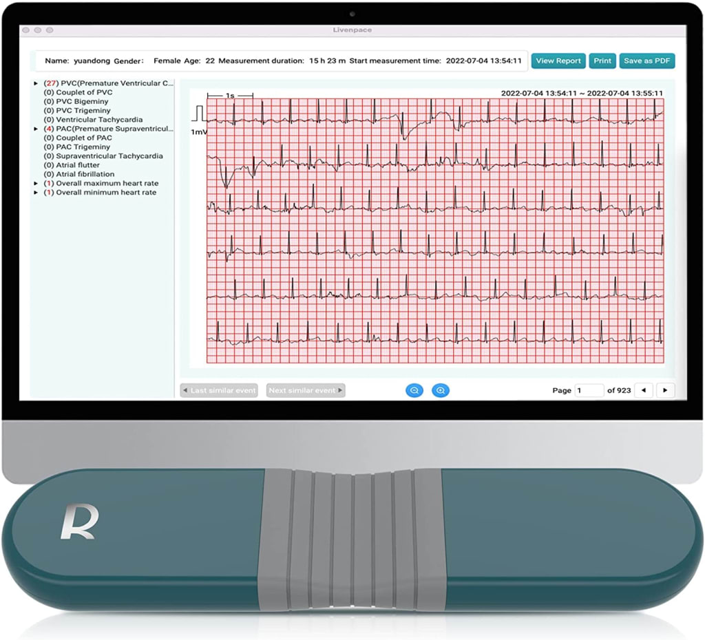 Livenpace 24-Hour AI ECG Holter for $180 w/ Prime - HHM1